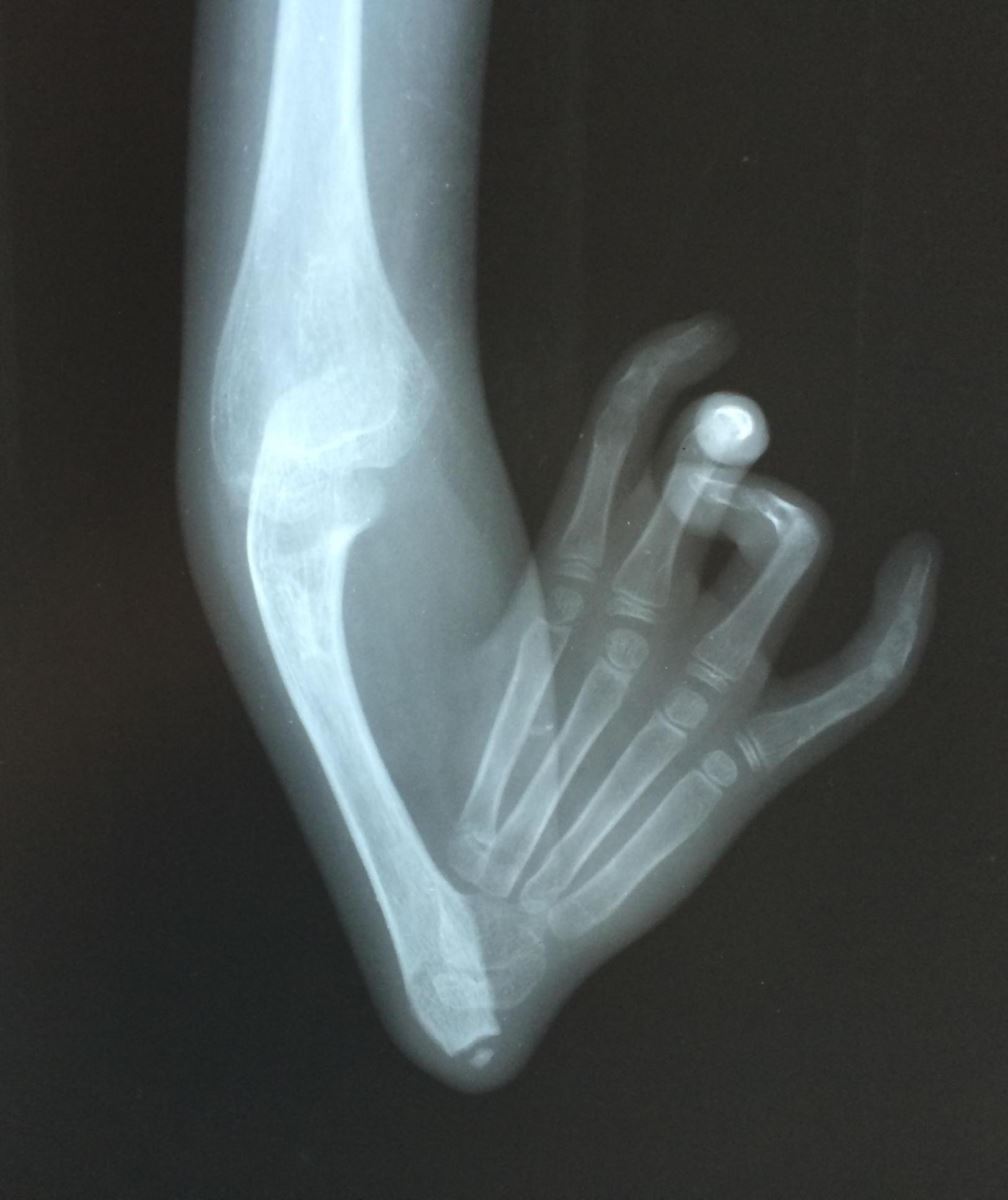 Chapter 7: Club Hand - APPI America