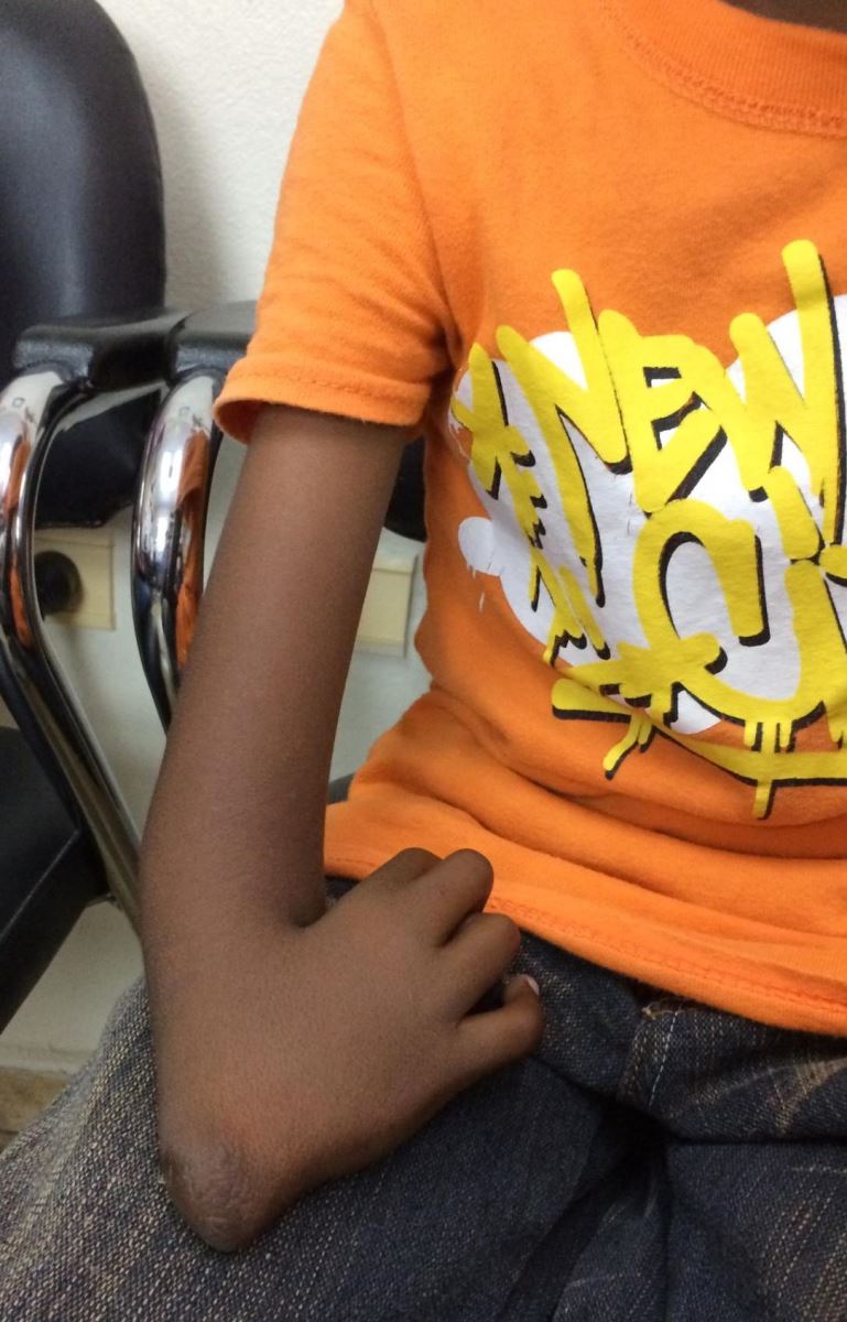 Chapter 7: Club Hand - APPI America