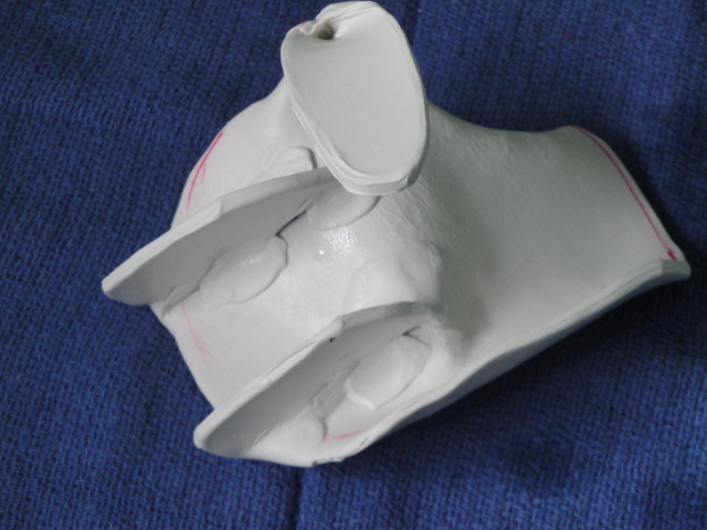 Splinting/ Mitten Hand - APPI America